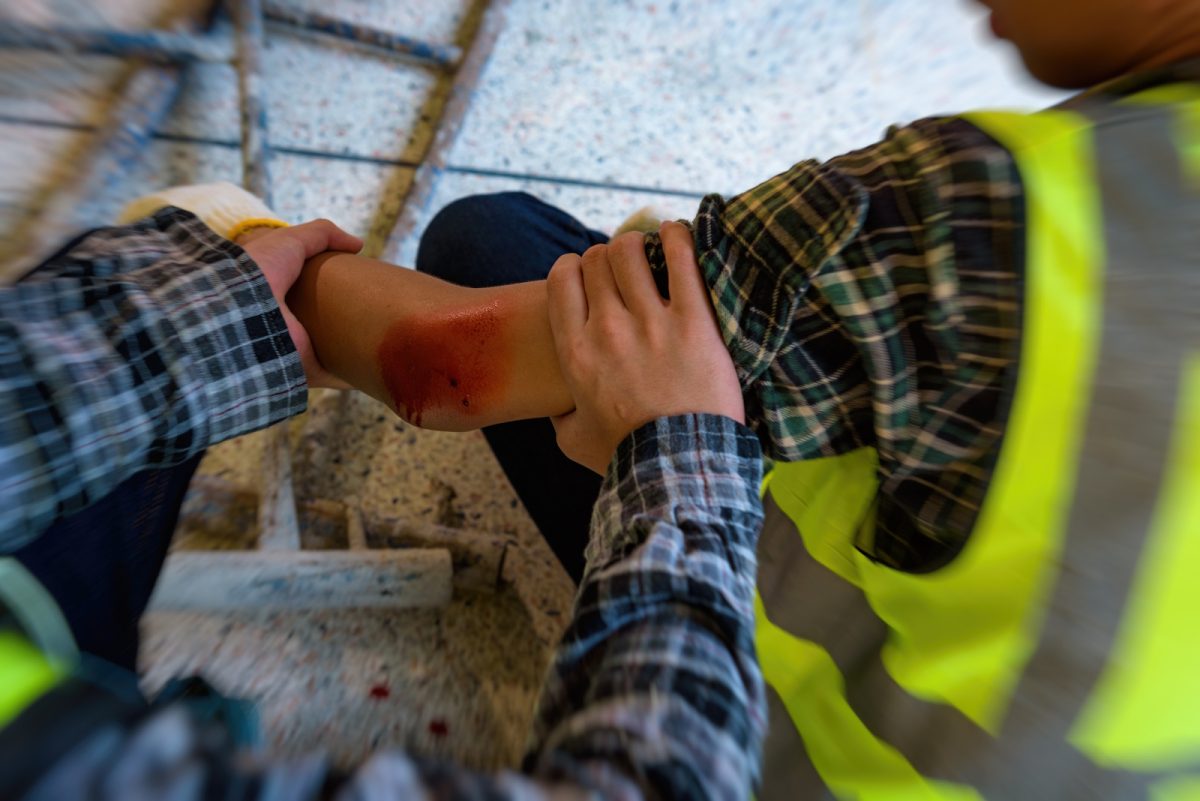How Much Compensation For Broken Arm At Work?