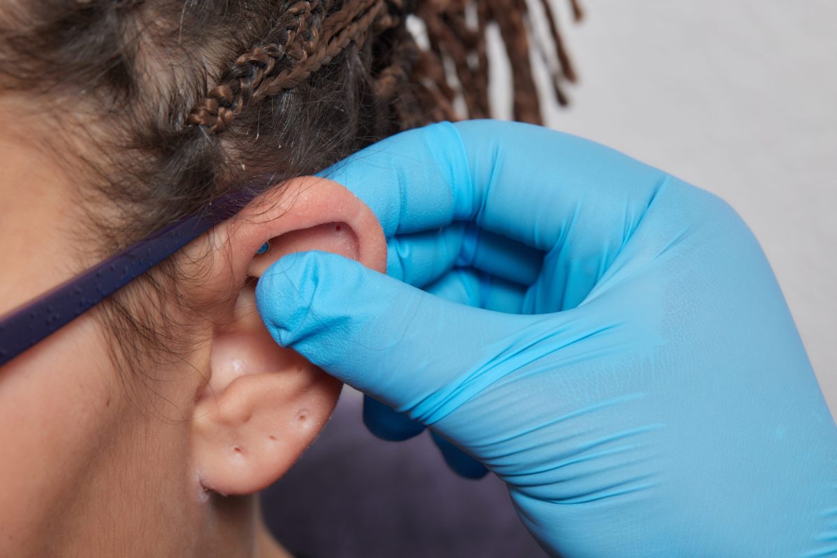 Ear Correction Surgery (Otoplasty) Negligence Claims